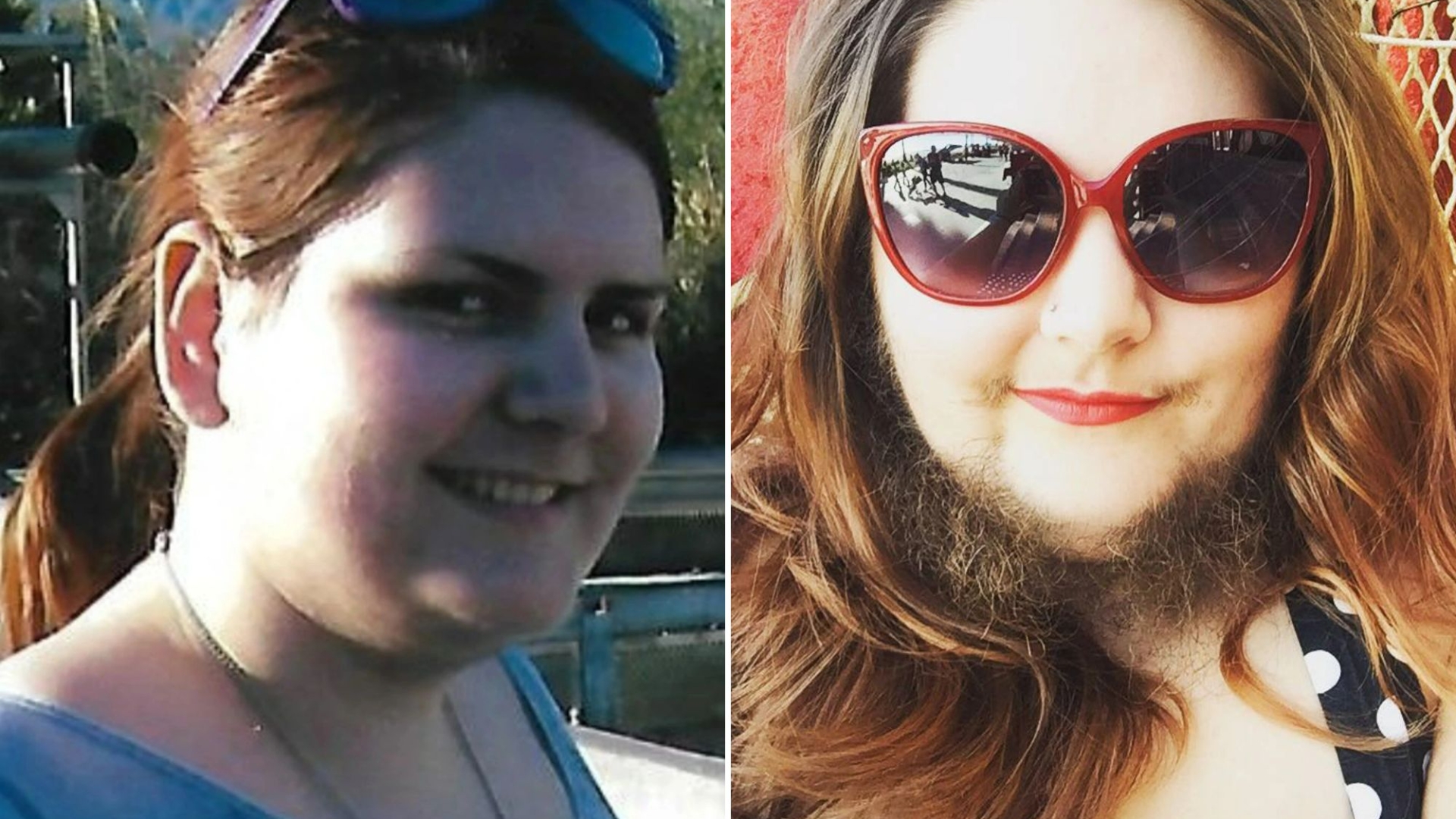 Dakota the Bearded Lady | TikTok | Linktree