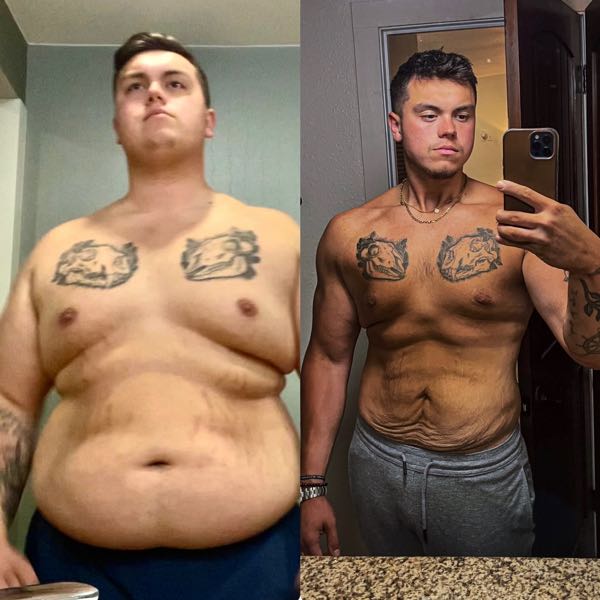 Amazon Bariatric Basics | Linktree